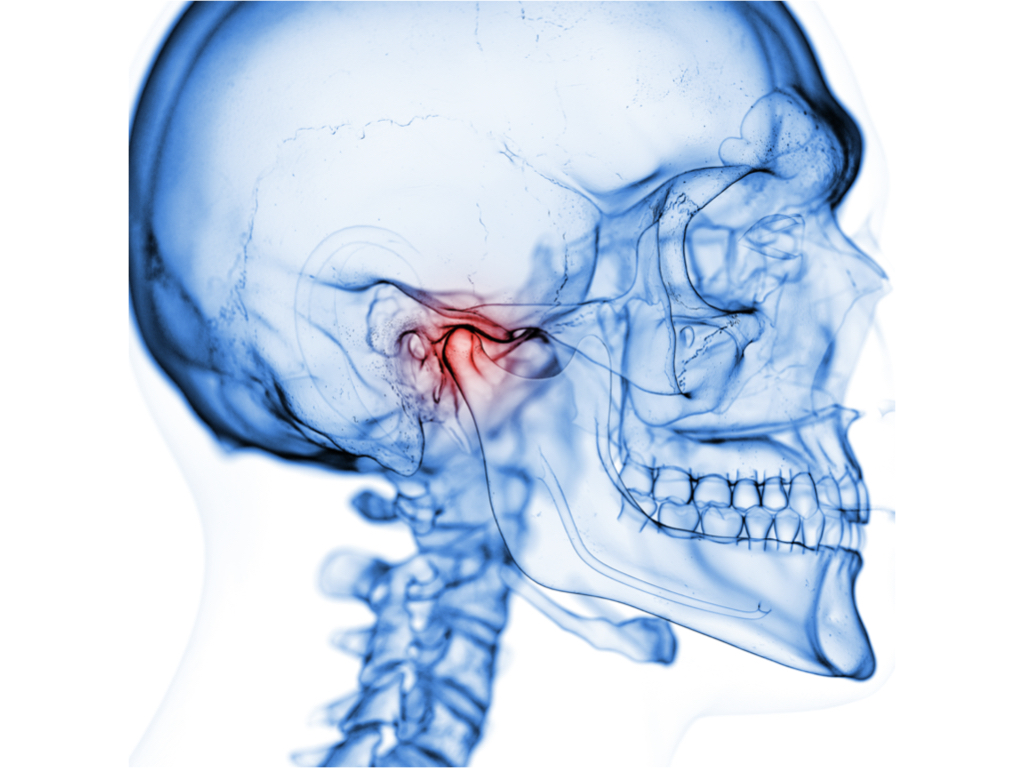 TMD Treatment Protocol - Smiles By Bis