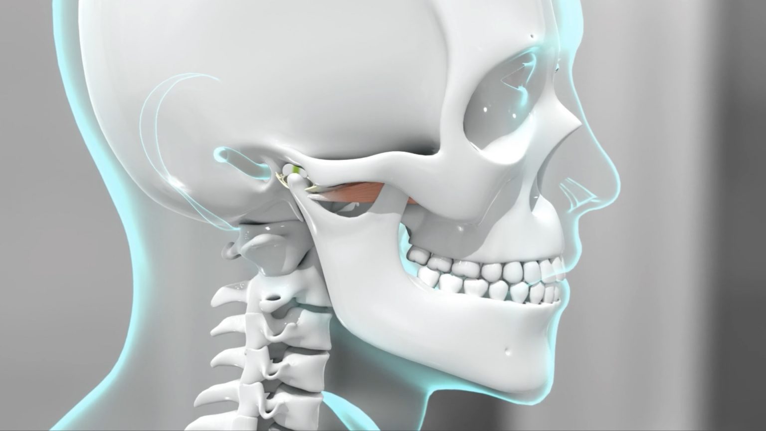 Posterior Disc Displacement in TMJ Disorder | Smiles by BIS