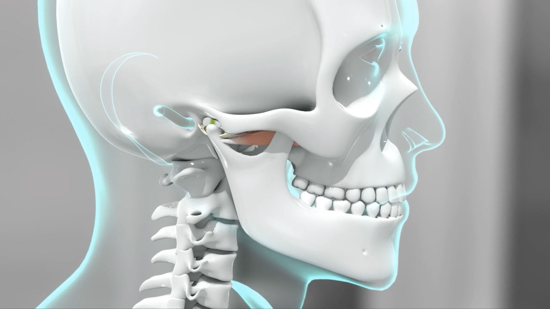 Posterior Disc Displacement in TMJ Disorder | Smiles by BIS